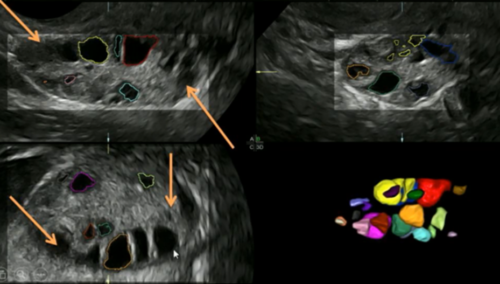 Supplement your reading