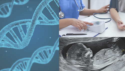 NiPT: first trimester ultrasound and pre-eclampsia screening