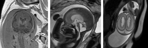 Basic Certificate of Fetal MRI
