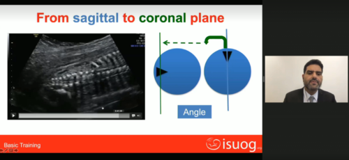 ISUOG celebrates the success of the first fully online Basic Training ...