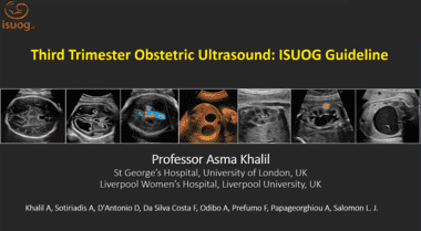 UOG videoclip: ISUOG Practice Guidelines: performance of third ...