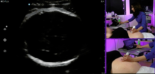 Point of care ultrasound in obstetrics and gynecology: from ambulatory ...