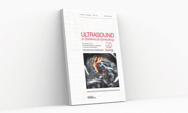 Ultrasonics Journal A) Schematic Of The Ultrasound Assisted Synthesis