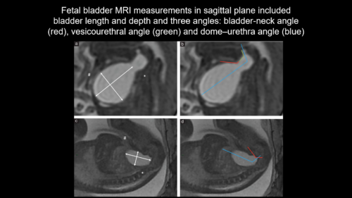 UOG video clip: Biometric and morphological features on magnetic ...