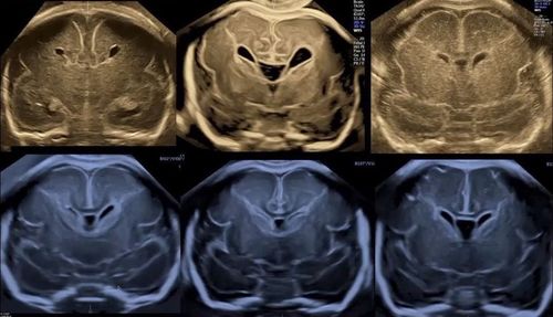 Exploring the fetal brain: imaging, prognosis and counselling