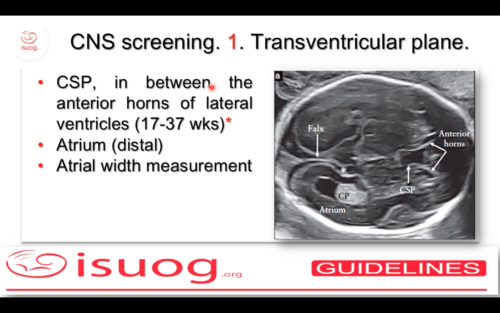 ISUOG Practice Guidelines (updated): sonographic examination of the ...