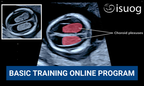 ISUOG Basic Training Online Program