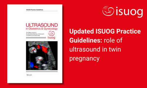 Newly Updated Isuog Practice Guidelines Role Of Ultrasound In Twin