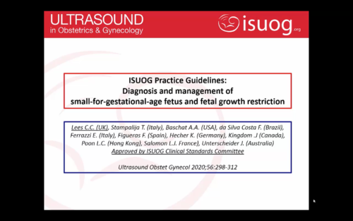 UOG video clip: Summary of ISUOG Practice Guidelines on the diagnosis ...
