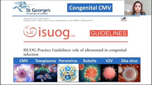 UOG video clip: Summary of ISUOG Practice Guidelines on the role of ...