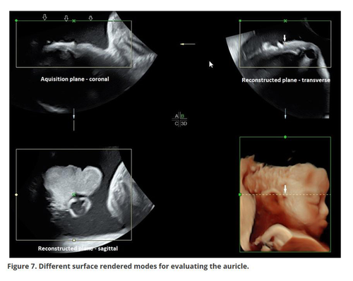 VISUOG: Interview with Fetal Ear Radiologist, Dr Ian Suchet