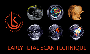 EARLY FETAL SCAN TECHNIQUE