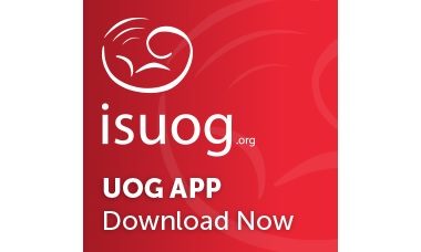 UoG app