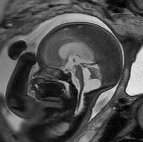 Essentials in Fetal MRI: methods and brain imaging